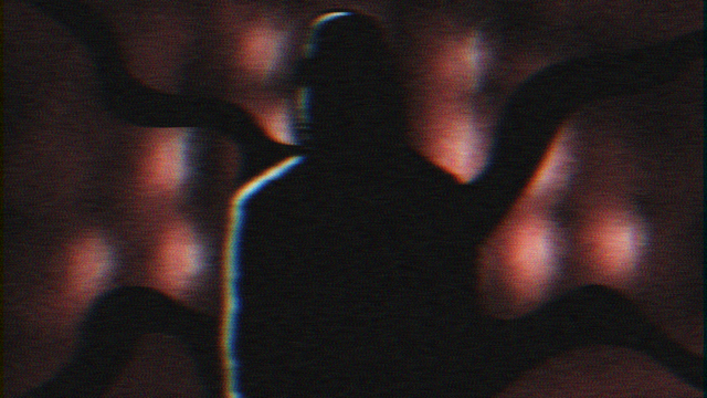 Patient-025 - The Soysylum